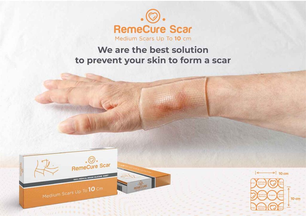 RemeCure Scar M 10cm - RemeCure